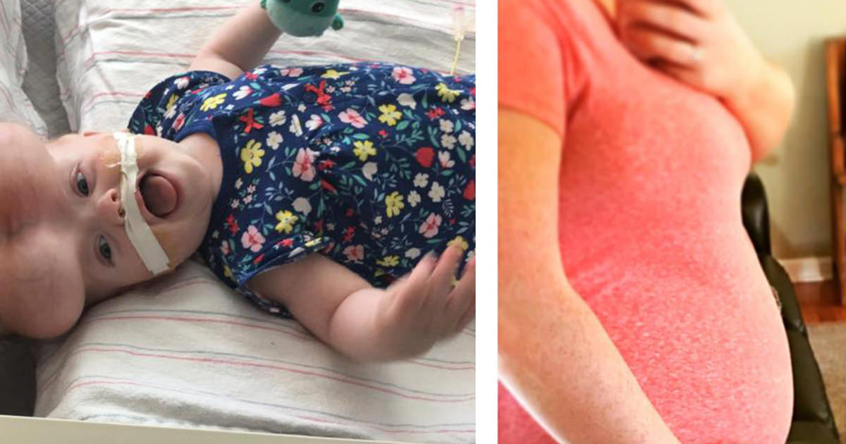 אישה גילתה שהיא מצפה לתאומות - 11 שבועות אחר כך, האולטרסאונד גילה שהן 1 ...