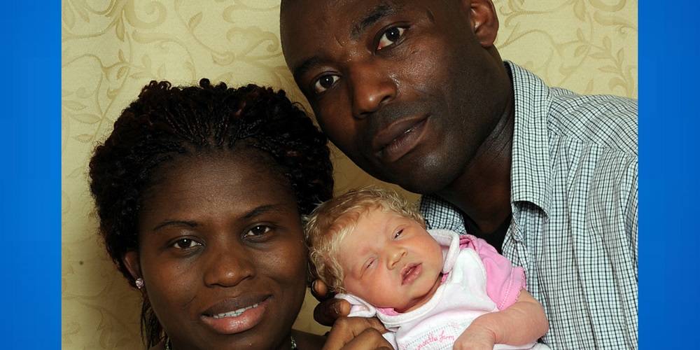 הורים היו בשוק כשהתינוק נולד עם שיער בלונדיני - ההיסטוריה הלא צפויה של ...